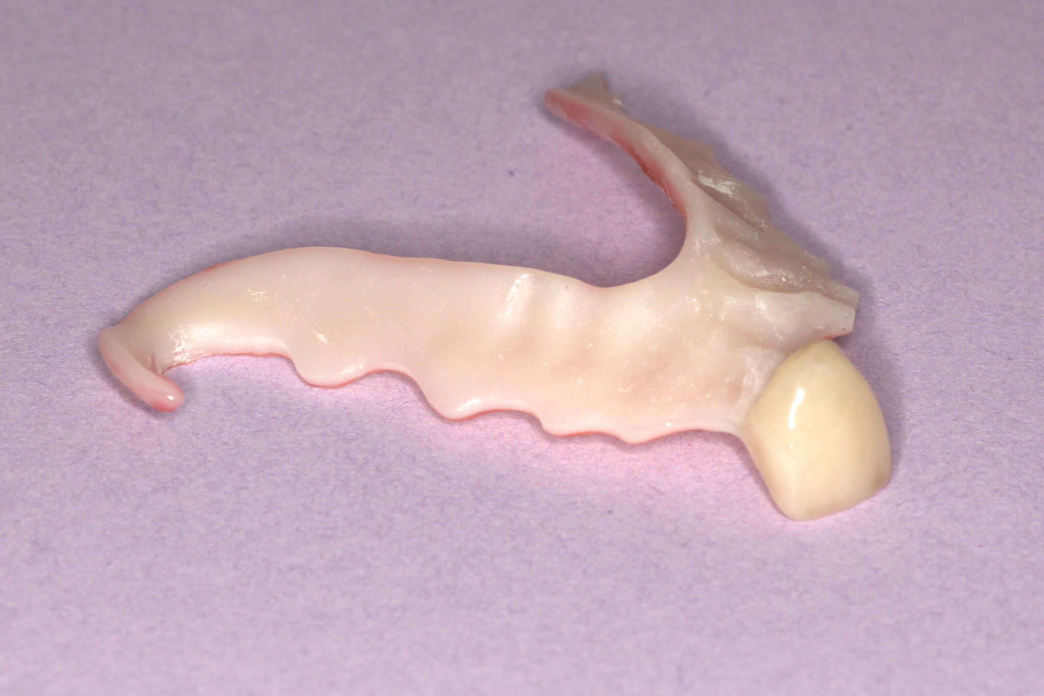 Partial Dentures for Front and Back Teeth - What Are My Options?