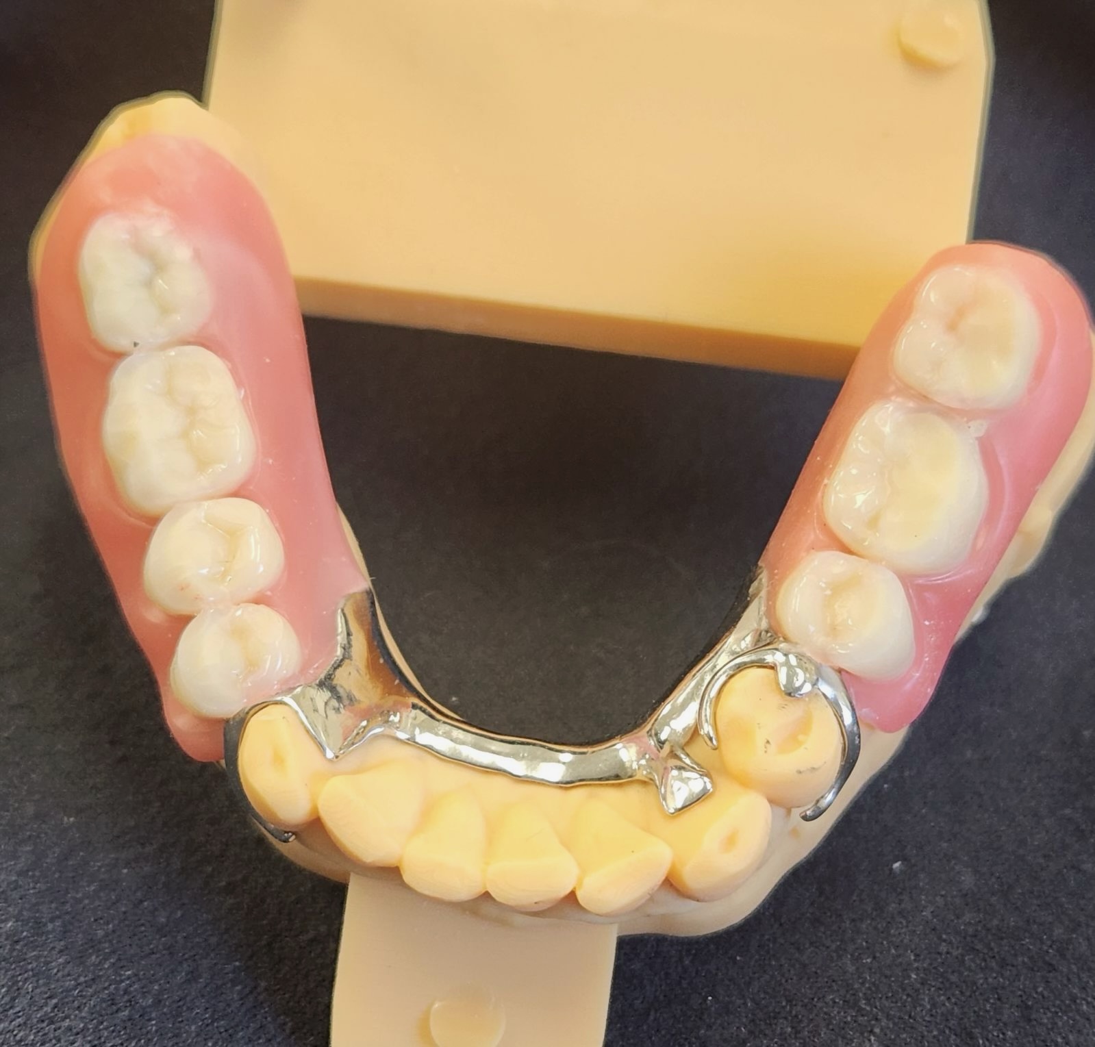 Partial Dentures for Front and Back Teeth - What Are My Options?