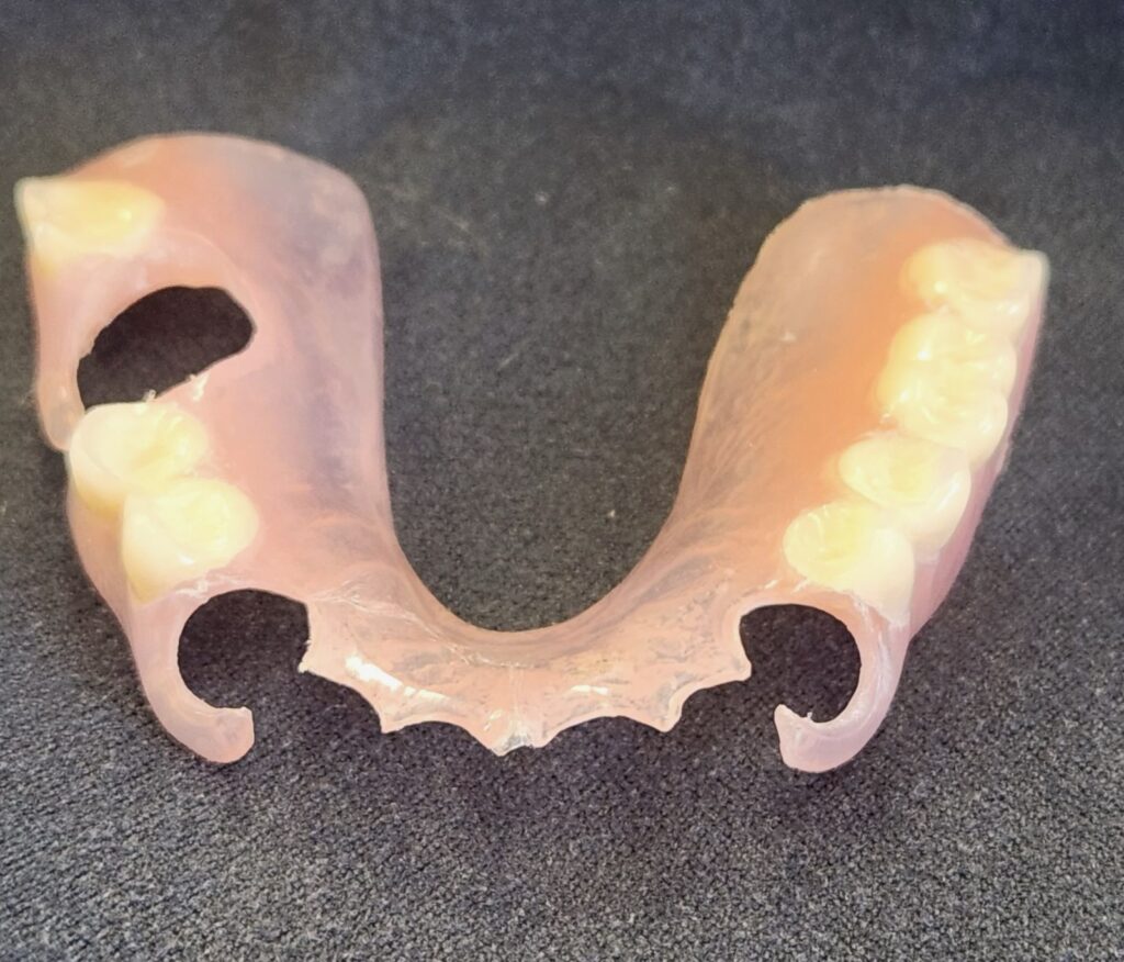Partial Dentures for Front and Back Teeth - What Are My Options?