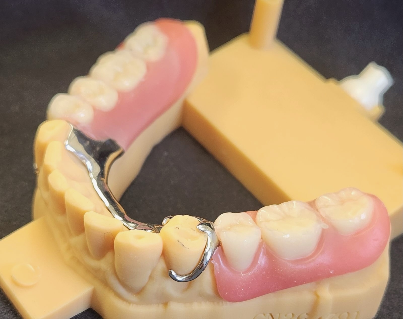 Partial Dentures for Front and Back Teeth - What Are My Options?