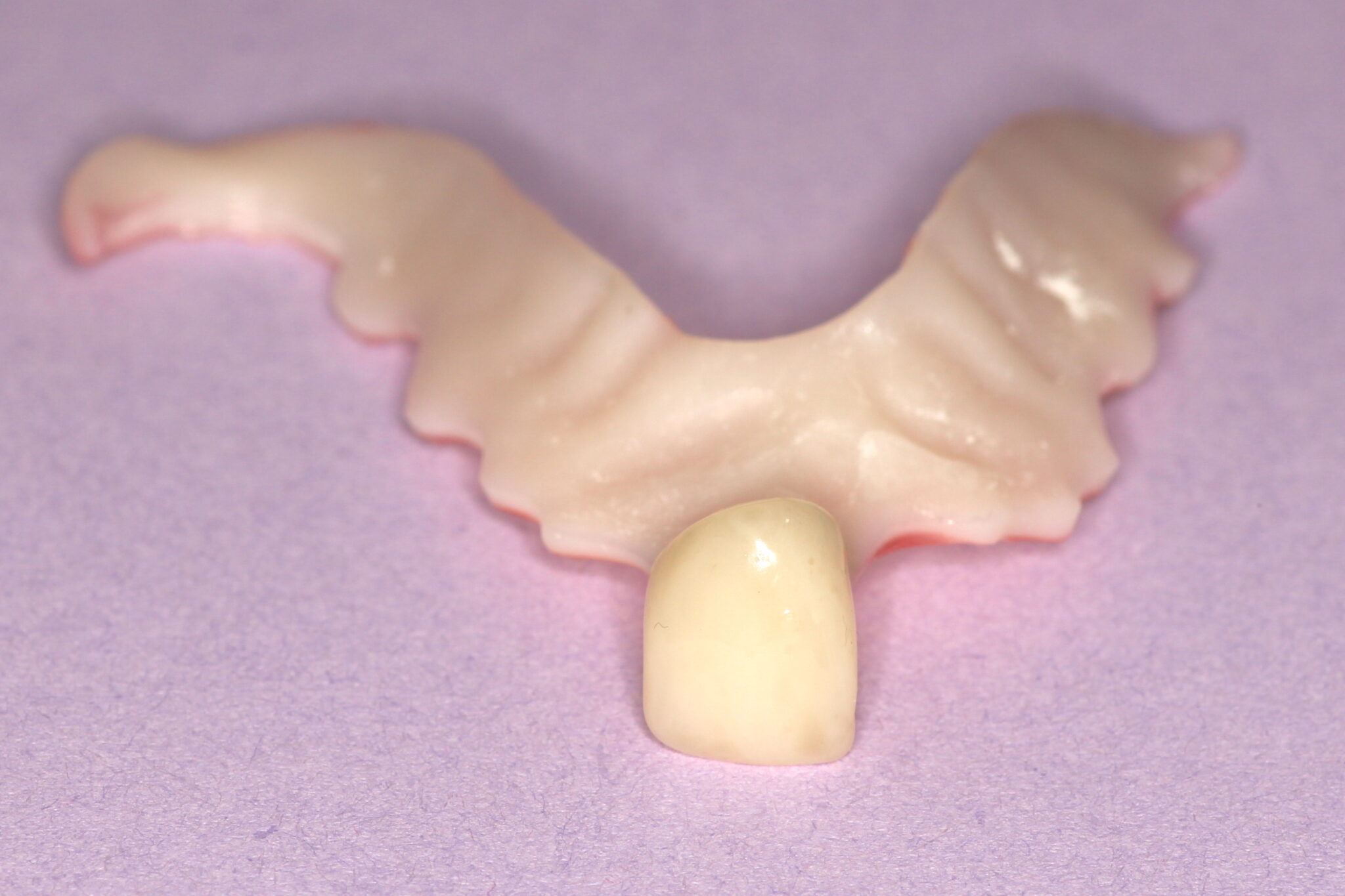Partial Dentures for Front and Back Teeth - What Are My Options?